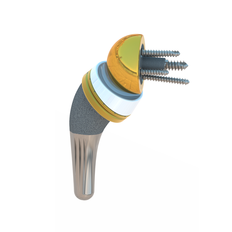 ISA Onlay prothèse totale d'épaule inversée - Shoulder Friends Institute